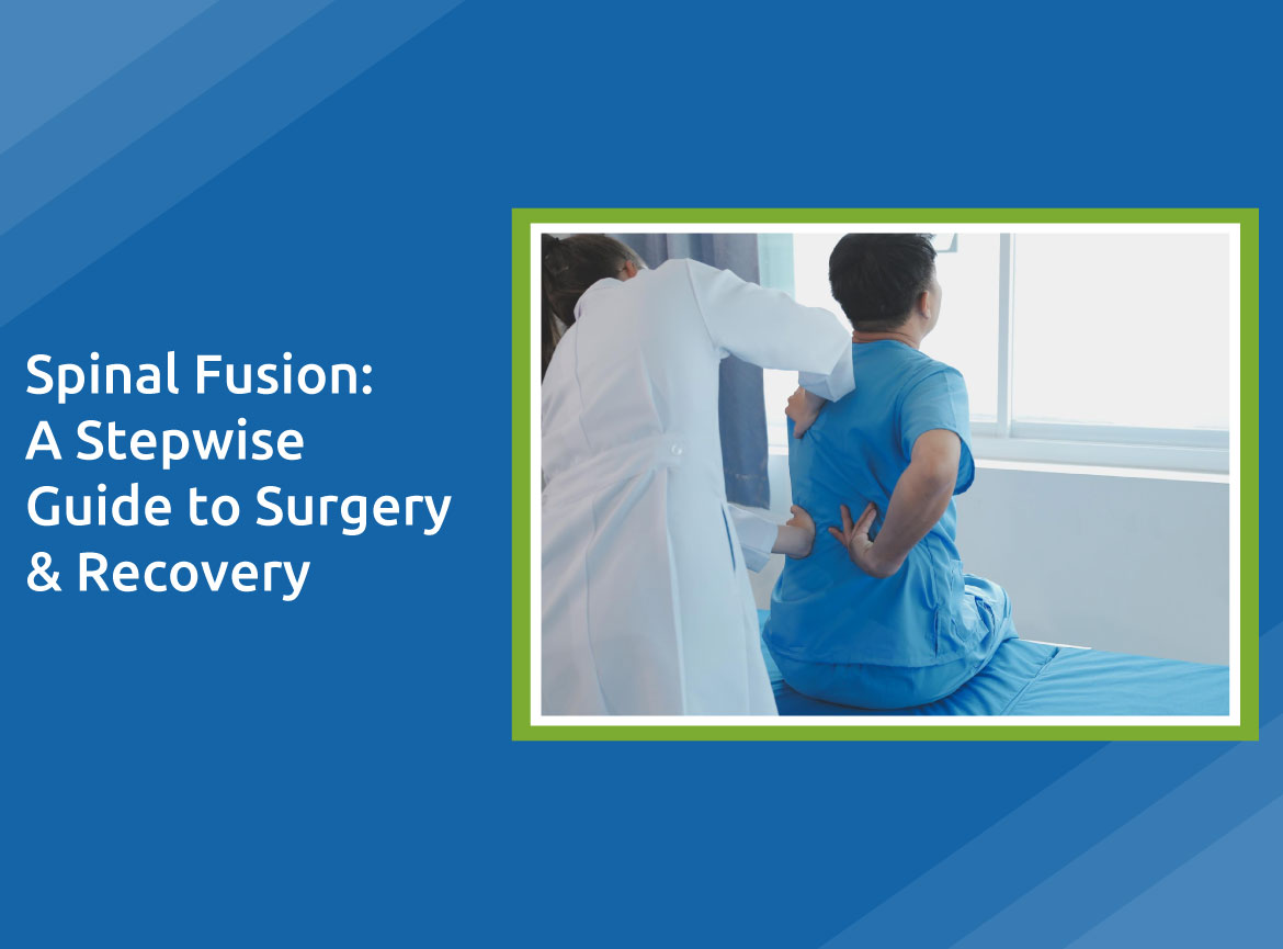 Spinal Fusion: A Stepwise Guide to Surgery & Recovery - Dr. Tanay ...