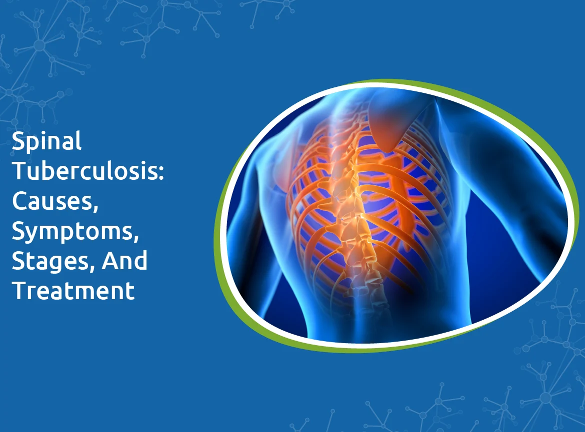 Spinal Tuberculosis: Causes, Symptoms, Stages, and Treatment Options